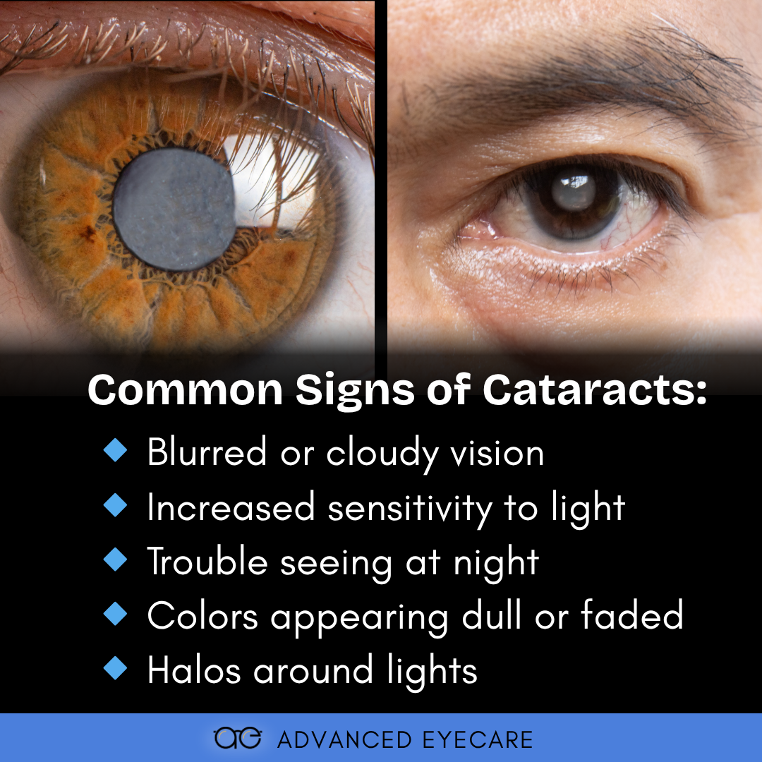 Discover the signs and symptoms of cataracts and learn why early ...